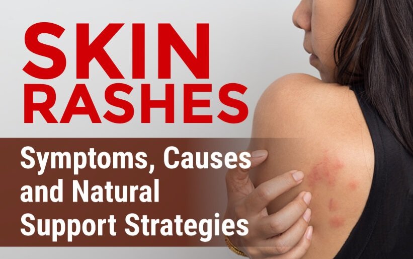 How Stress Can Cause a Skin Rash or Hives (and How to Treat Them ...