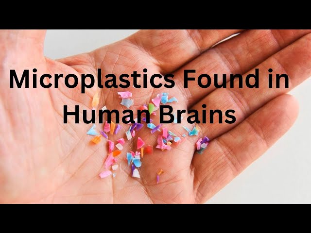 Reduce Microplastic Brain Exposure by 90% – Stay Healthy Weekly Magazine